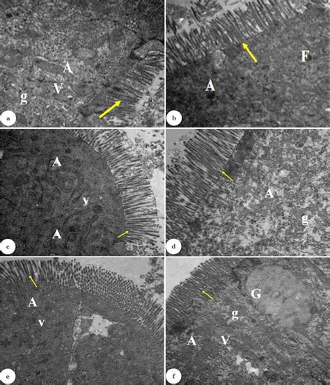 Electron Microscopic Examination Of The Duodenum Group 2 Aviboost And Download Scientific