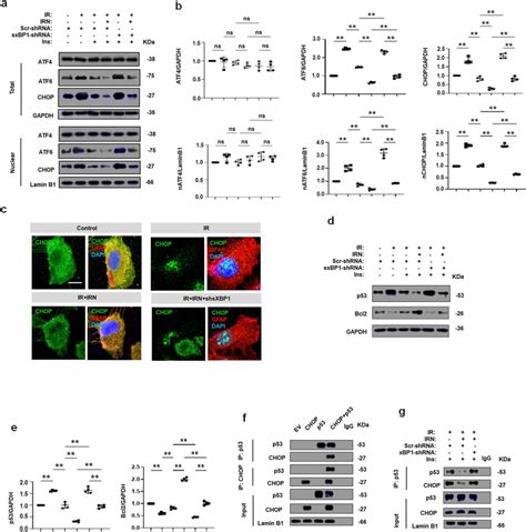 Irn Rescues Apoptosis And Ers By Targeting Sxbp1 In Insulin Resistant