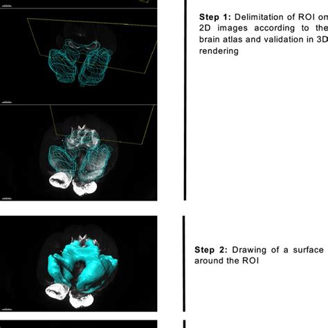 Distribution Of Th Immunoreactivity In P5 Mouse Brain A Sagittal