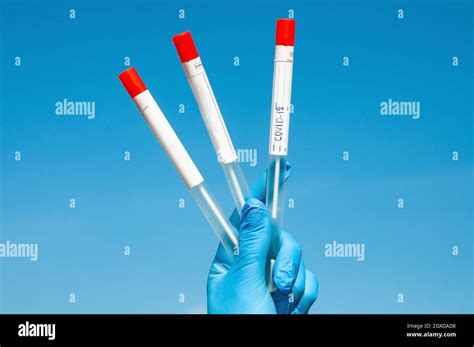 Biochemical Tests Bacteria Hi Res Stock Photography And Images Alamy