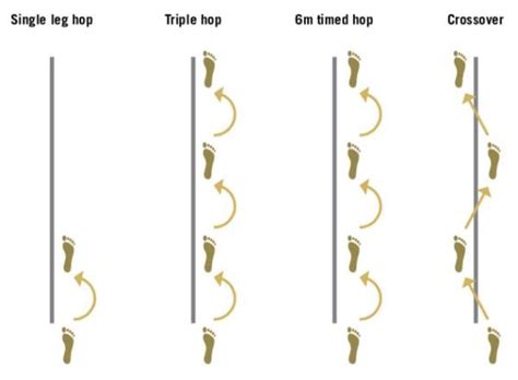 Acl Surgery Return To Sport Testing Pogo Physio Gold Coast