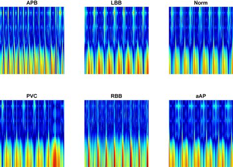 mel scale spectrogram of six ecg beats classes download scientific