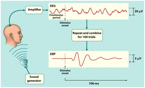 7 Eeg And Event Related Potentials With A Focus On Language Flashcards Quizlet