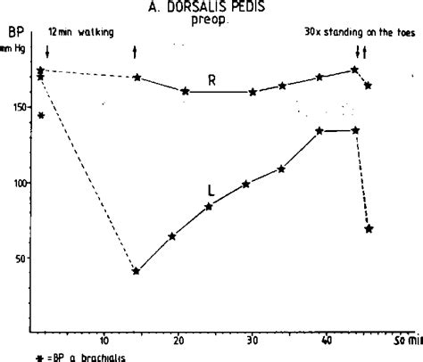 Figure 2 From Cystic Adventitial Degeneration As A Cause Of Dynamic Stenosis Of The Popliteal