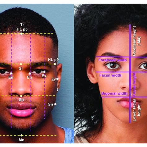 a the ratio of facial width to bigonial width r7 1 12 in males