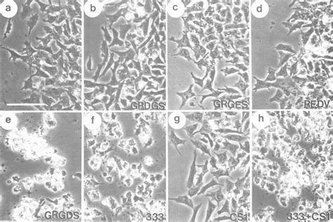 Morphology Of Migrating Neural Crest Cells In The Absence Of Peptide Or Download Scientific