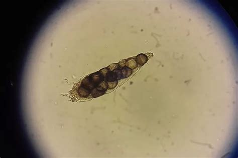 Man Finds Mites That Have Sex On Your Face In Your Sleep Living In