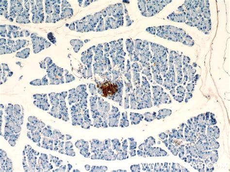 Insulin Rabbit Anti Human Mouse Rat Polyclonal Proteintech
