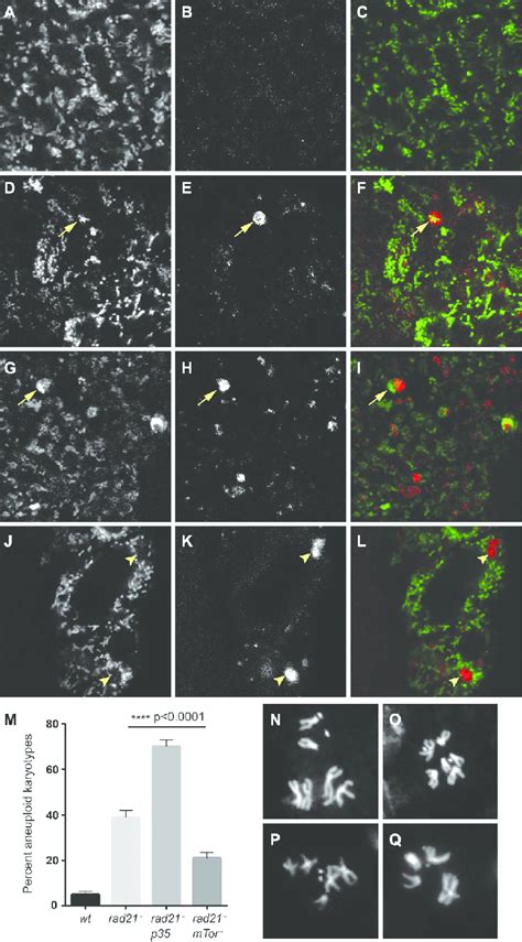 Autophagy Of Mitochondria Is Observed In Cin Cells And Increased
