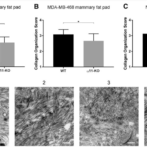 Collagen Fibril Organization Transmission Electron Microscopy Pictures