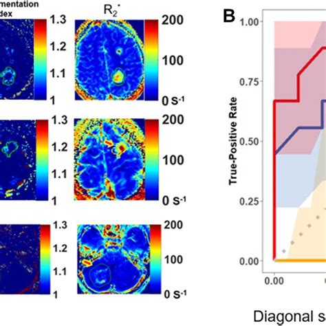 Performance Of Discriminators For Classification Of Responding Tumor