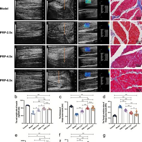High Frequency Ultrasound Shear Wave Elastography Swe And Download Scientific Diagram