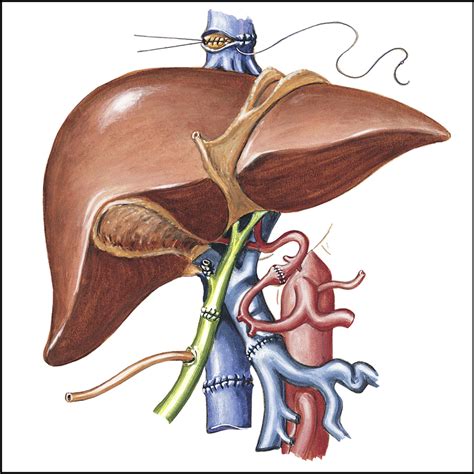 Liver Transplant Procedure Steps At Aidan Bavister Blog