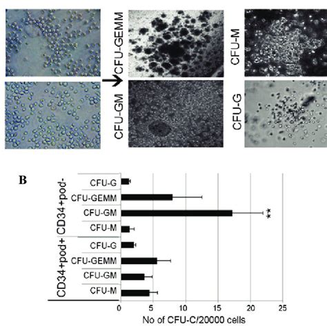 Leukemic Derived Cfu Assay In Cd34 Podoplanin Or Cd34 Download Scientific Diagram