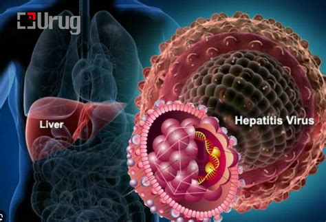 Гепатитын D вирусийн халдвартай иргэдийн эмийн зардлыг улсын төсвөөс хариуцна