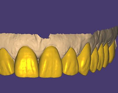 Exocad Tooth Projects Photos Videos Logos Illustrations And Branding Behance