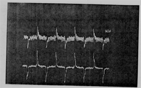 Anc Real Time Performance Using Lms Algorithm Download Scientific Diagram