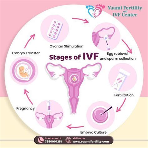 Iui Vs Ivf Should You Choose Iui Or Ivf When Ttc Artofit