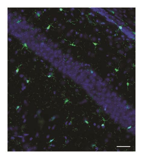 Representative Immunohistochemical Staining Of Iba1 Green In Coronal