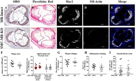 Smc Mr Deletion Does Not Significantly Alter Aortic Root Plaque Size Or Download Scientific