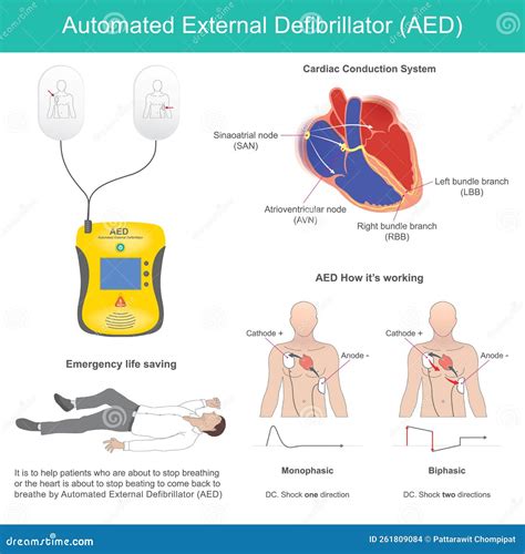 Automated External Defibrillator Stock Vector Illustration Of Shock