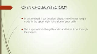 Cholecystectomy PPTX