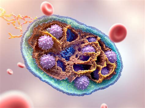 多发性骨髓瘤诊断标准 骨髓瘤常识 骨髓瘤 肿瘤疾病大全 癌症肿瘤科普知识 有来医生