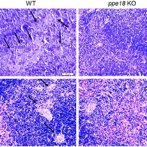 Histopathology Of Lungs From Mice Infected With Wild Type Wt Or Ppe18