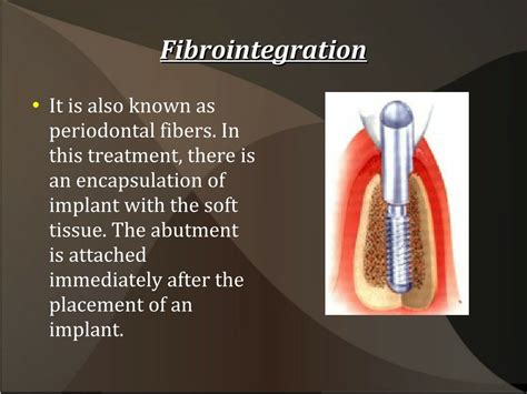 Ppt Dental Implant And Classification Powerpoint Presentation Free
