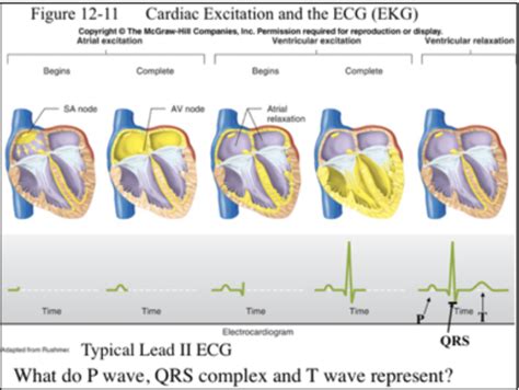 Ecg Flashcards Quizlet