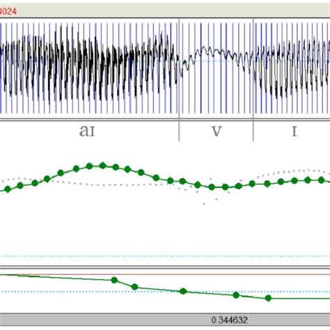 a schematic display of overlapping speech signal segments using td psola download scientific