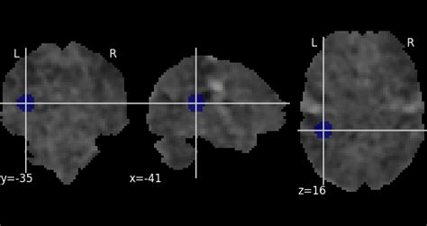 Create A 10mm Sphere Roi Mask Around A Given Coordinate Nilearn Neurostars