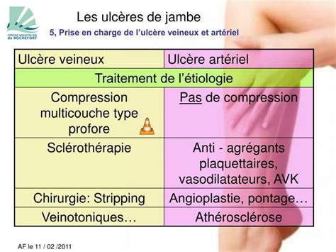 Ppt Les Ulcères De Jambe Powerpoint Presentation Id 4486747