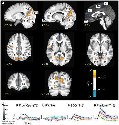 Luxotonic Signals In Human Prefrontal Cortex As A Possible Substrate