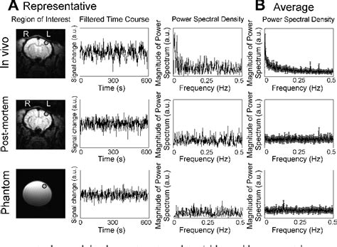Figure 2 From Frequency Distribution Of Causal Connectivity In Rat