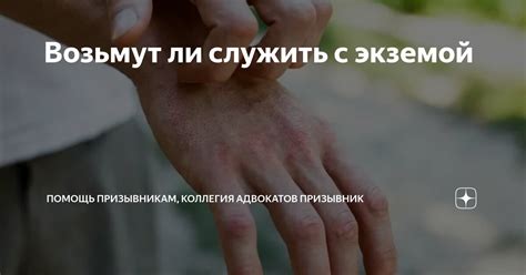 Возьмут ли служить с экземой Помощь призывникам коллегия адвокатов Призывник Дзен