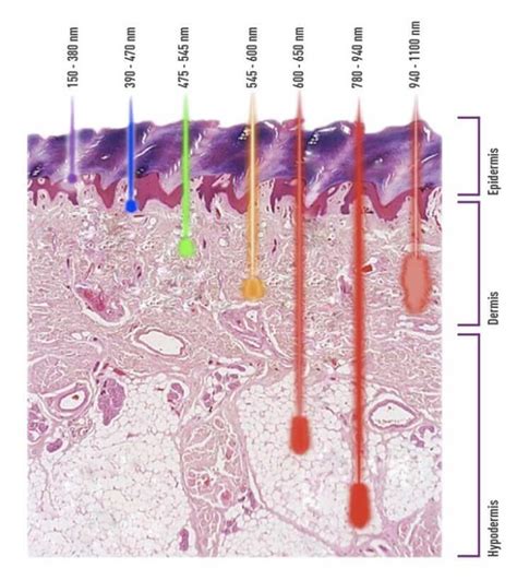 Intense Pulsed Light How It Differs From Laser And What To Expect