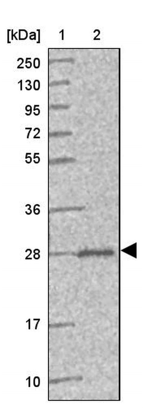 Pex11b Antibody Pa5 62135