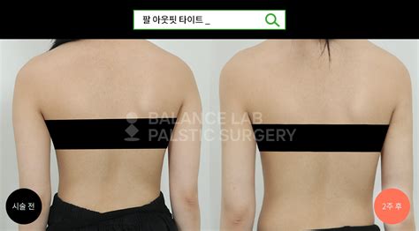 밸런스랩 성형외과