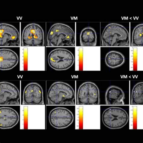 Real‐time Whole Brain Fmri Processing Images Verbal Fluency