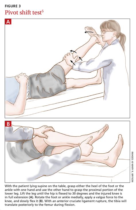 Lateral Pivot Shift Test Knee