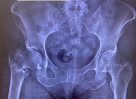 Anatomy Gluteal Region Flashcards Quizlet