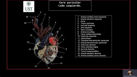 Anatomía De Corazón De Canino Y Pulmón De Felino Youtube