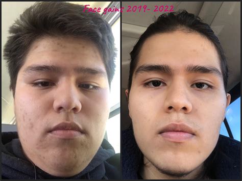 6717 Best If Cico Images On Pholder Cico Progresspics And 1200isfine Igues Sugh