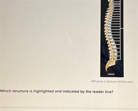 Solved A Spinous Processes B Vertebra Prominens C7 C
