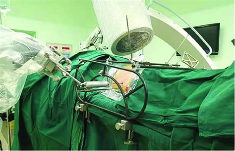 Pelvic Reduction Frame Cooperation With The C Arm And The Navigation Robot Download Scientific