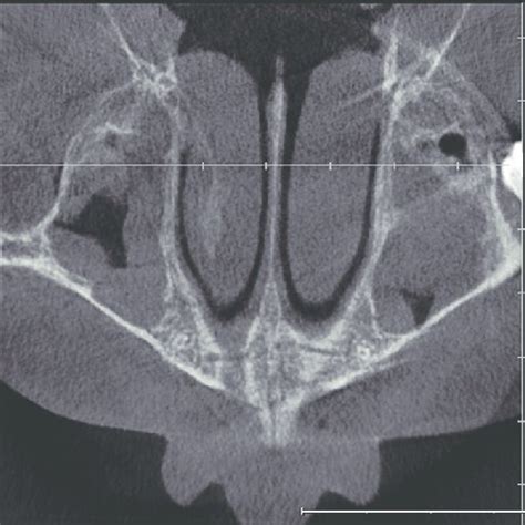 The Three Dimensional Cone Beam Computed Tomography Reconstruction Download Scientific Diagram