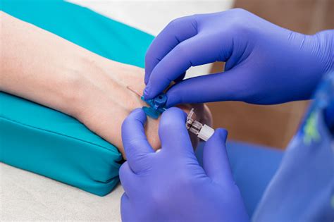 화학 요법의 물방울에 대 한 환자 또는 다른 액체 약을 정 맥에 블루 라텍스 장갑 입력 카 테 터와 의료 간호사 간호사에 대한 스톡 사진 및 기타 이미지 Istock