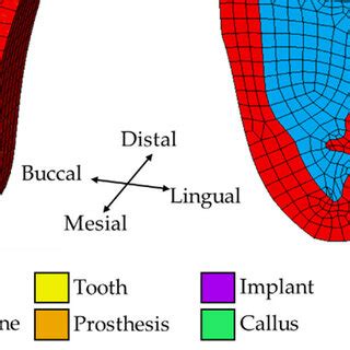 FEM Model Of A Bone Tooth And B Bone Implant Prosthesis Systems Download Scientific Diagram