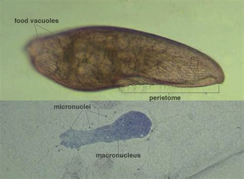 Protist Images Blepharisma Japonicum